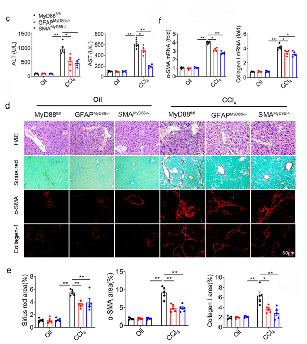 Cell Death Dis︱ 张金华课题组揭示肝纤维化新机制：肝星形细胞中MyD88通过促进巨噬细胞M1极化增强肝纤维化 - 知乎