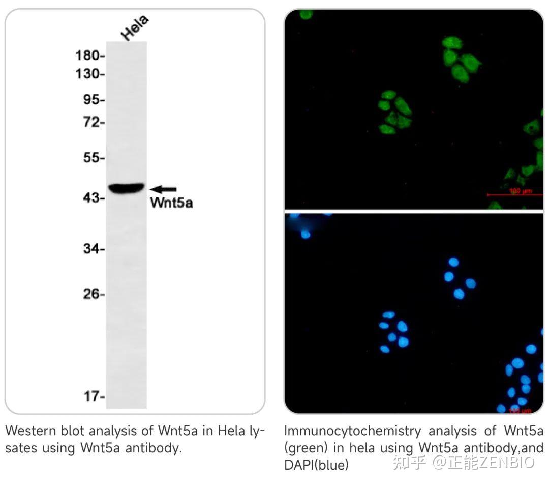 【研究专题】细胞信号传导的关键角色—Wnt通路 - 知乎