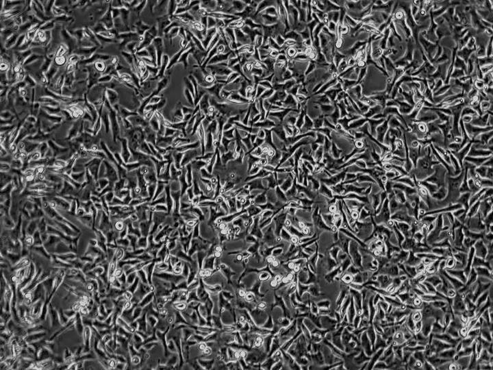 B16-F10(小鼠皮肤黑色素瘤细胞）细胞培养建议 - 知乎