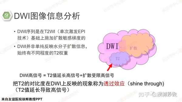 DWI序列判读原则及临床应用 - 知乎