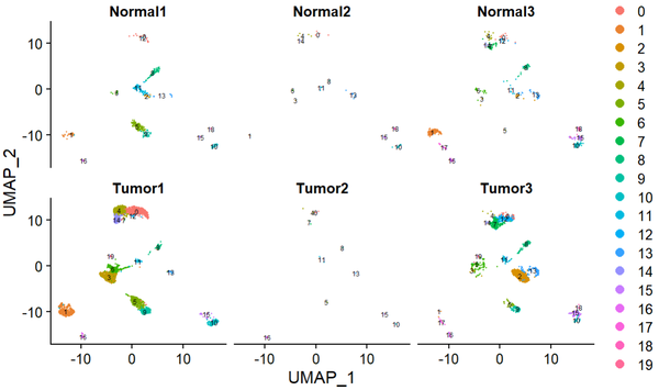 （附代码）单细胞转录组全流程整理三：scRNA-seq UMAP降维聚类 - 知乎