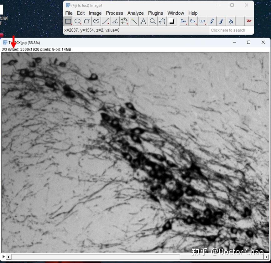 组化片子如何利用Image J 进行阳性信号面积占比统计分析 - 知乎