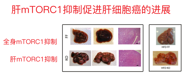雷帕霉素(2)促癌：抑制mTOR反而促癌，是癌胞阴险还是神药无能？ - 知乎