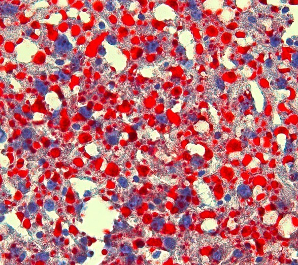 Imagej图像处理实践（ImageJ学习-图像处理 545367350） - 知乎