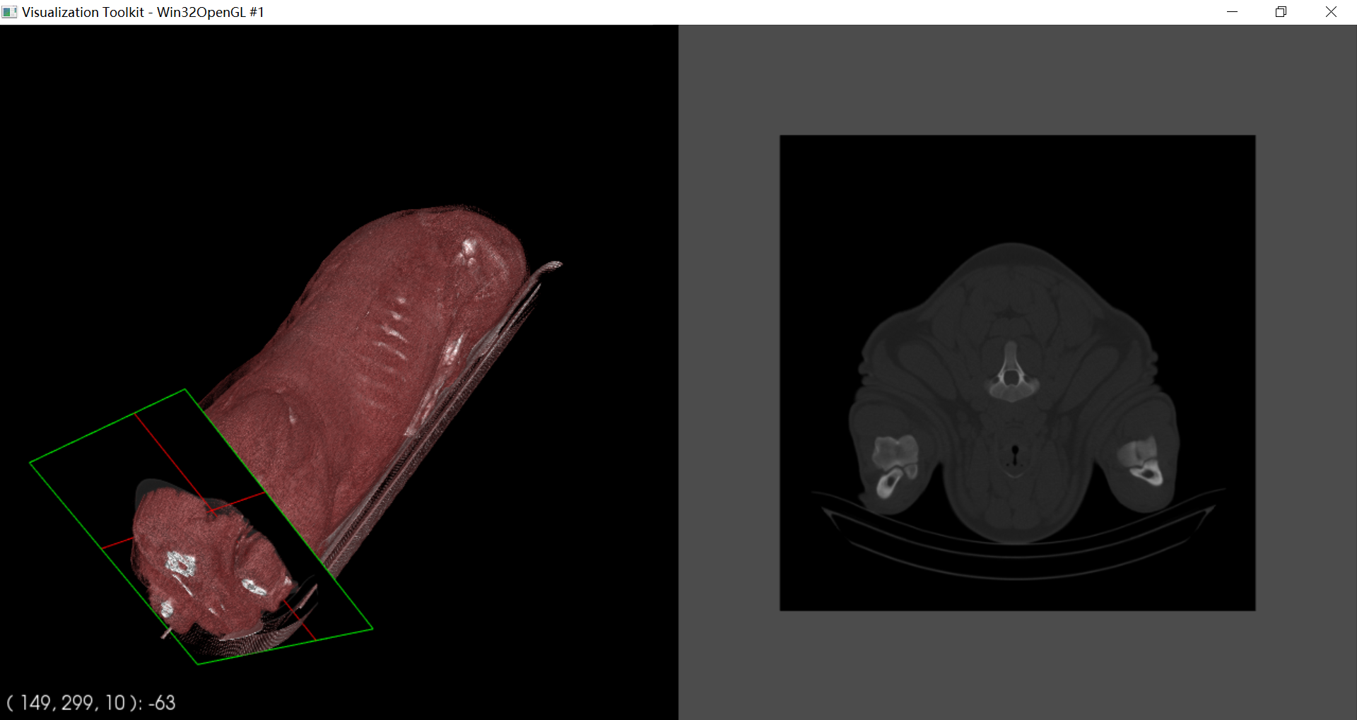 01 VTK体绘制（Volume Rendering）+ vtkImagePlaneWidget交互显示横截面 - 知乎