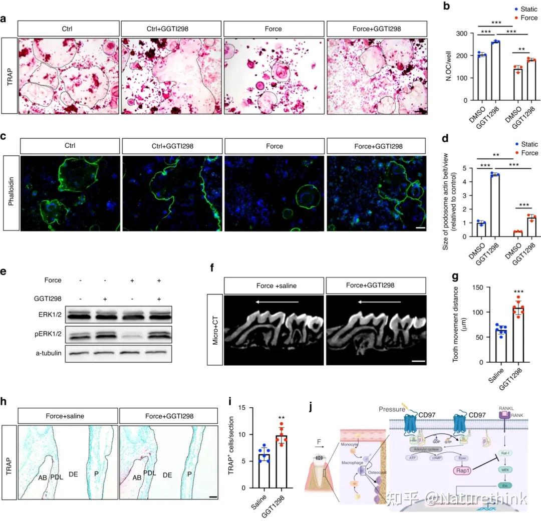 CD97 在压缩下通过 Rap1a/ERK 通路抑制破骨细胞分化 - 知乎