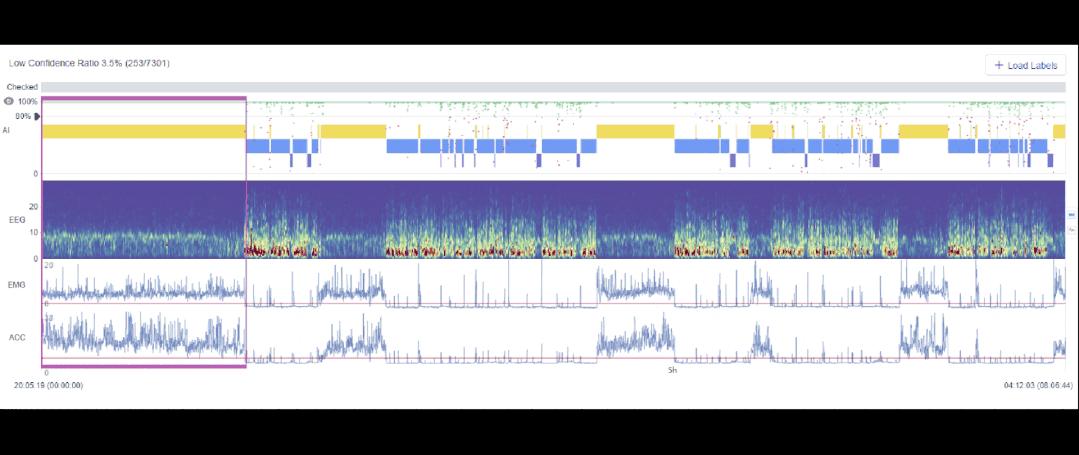 【脑科学】动物睡眠病状中的REM Sleep - 知乎