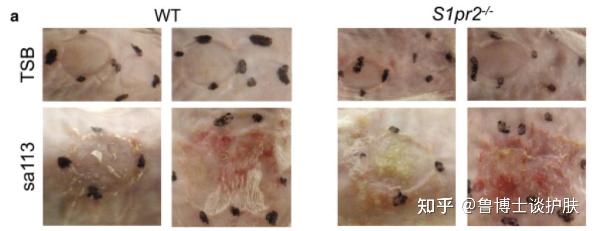 S1PR2是维持皮肤屏障稳态的关键蛋白 - 知乎
