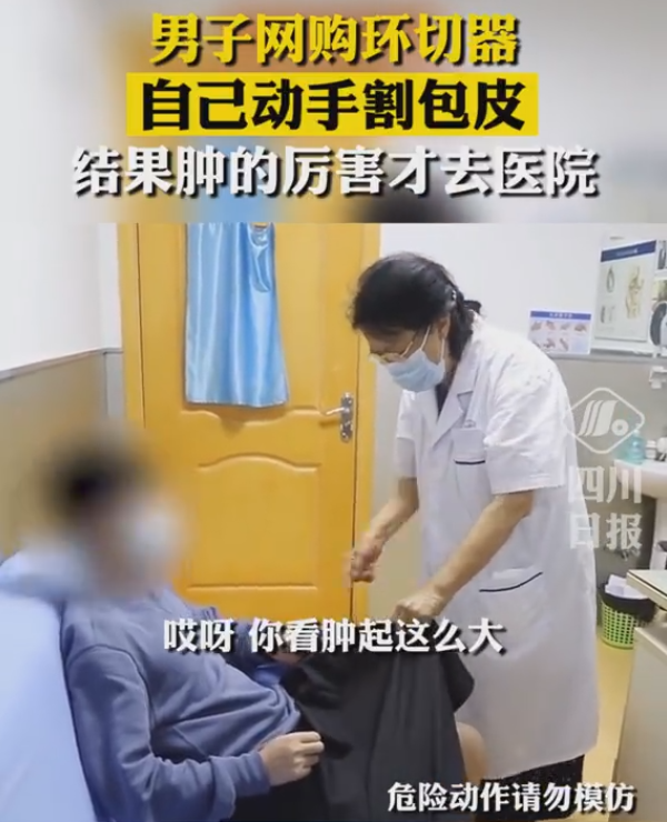 男宝都要割包皮吗?几岁割最好?一文说清 知乎