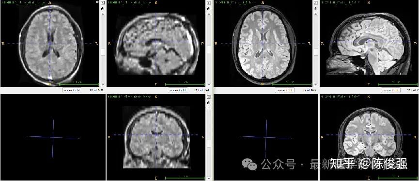 ULF-EnC2025——配对超低场 MRI 增强生成到高场 MRI - 知乎