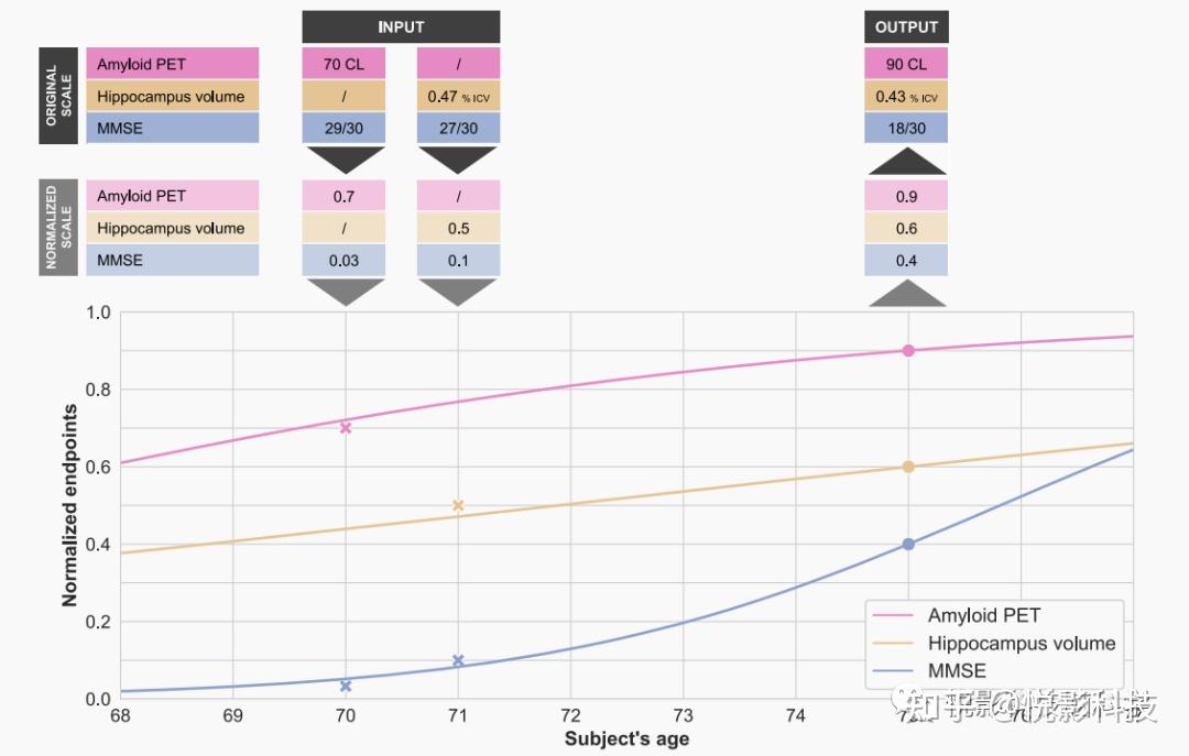 NC:预测阿尔茨海默病的个体进展轨迹 - 知乎