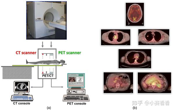PET-CT简史 - 知乎