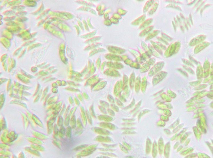 Microphyt 推出微藻来源原料，主打情绪和肠道健康 - 知乎