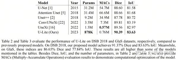 UNet家族迎来最小模型U-Lite | 800K参数实现性能极限超车 - 知乎
