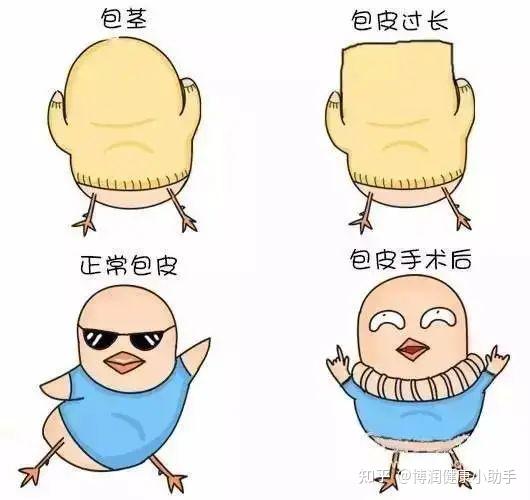 割包皮要趁 热”,暑假包皮手术黄金期不容错过!晋城博润微创外科医院为您提供最优质的服务。 知乎