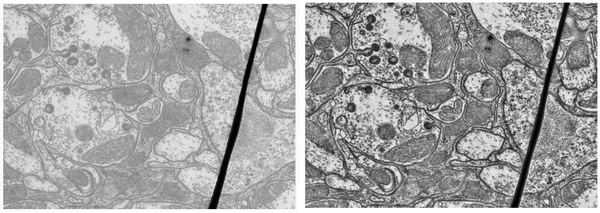Image Enhancement - CLAHE - 知乎