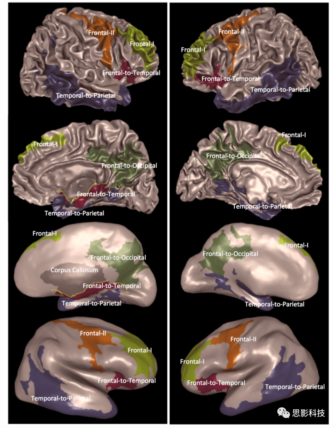 Science：Julich-Brain：一个新的细胞结构水平的概率脑图谱 - 知乎
