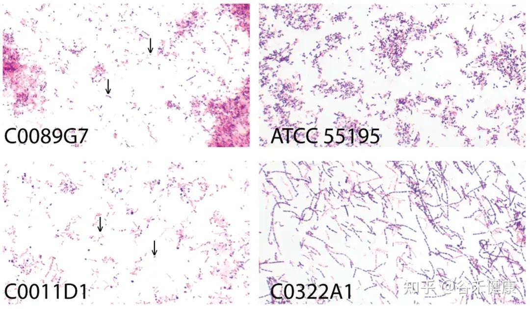 女性阴道健康基石菌中的特殊存在——惰性乳杆菌（Lactobacillus iners） - 知乎
