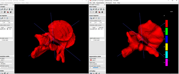 Nii图像处理、投影与生成 - 知乎