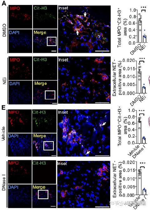 通过多篇10+高分文献结果揭示国自然热点中性粒细胞胞外诱捕网（NETs）相关实验 - 知乎
