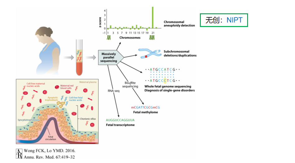 生信分析：无创产前检测 - 知乎