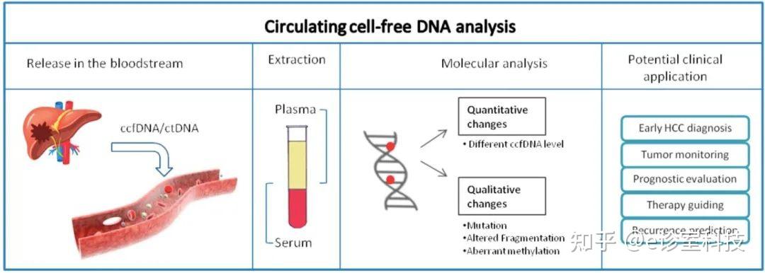 血液ctDNA在早期肝细胞癌患者术后MRD监测中的应用 - 知乎
