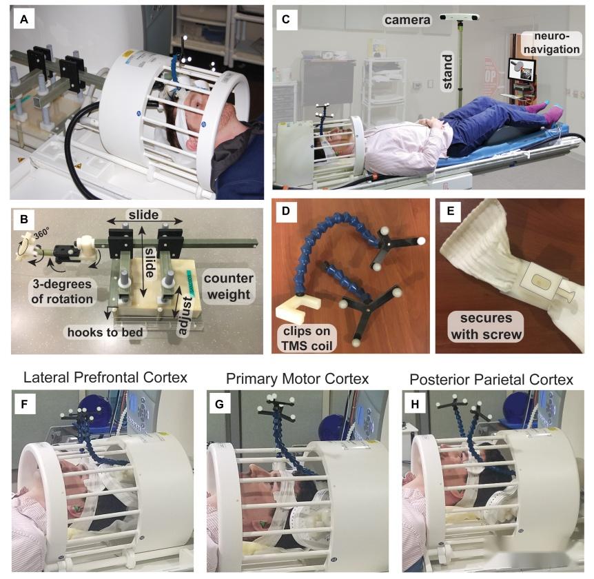 同步TMS-fMRI研究脑功能网络的指南 - 知乎