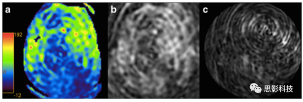 动脉自旋标记磁共振(ASL)的神经放射学家指南 - 知乎