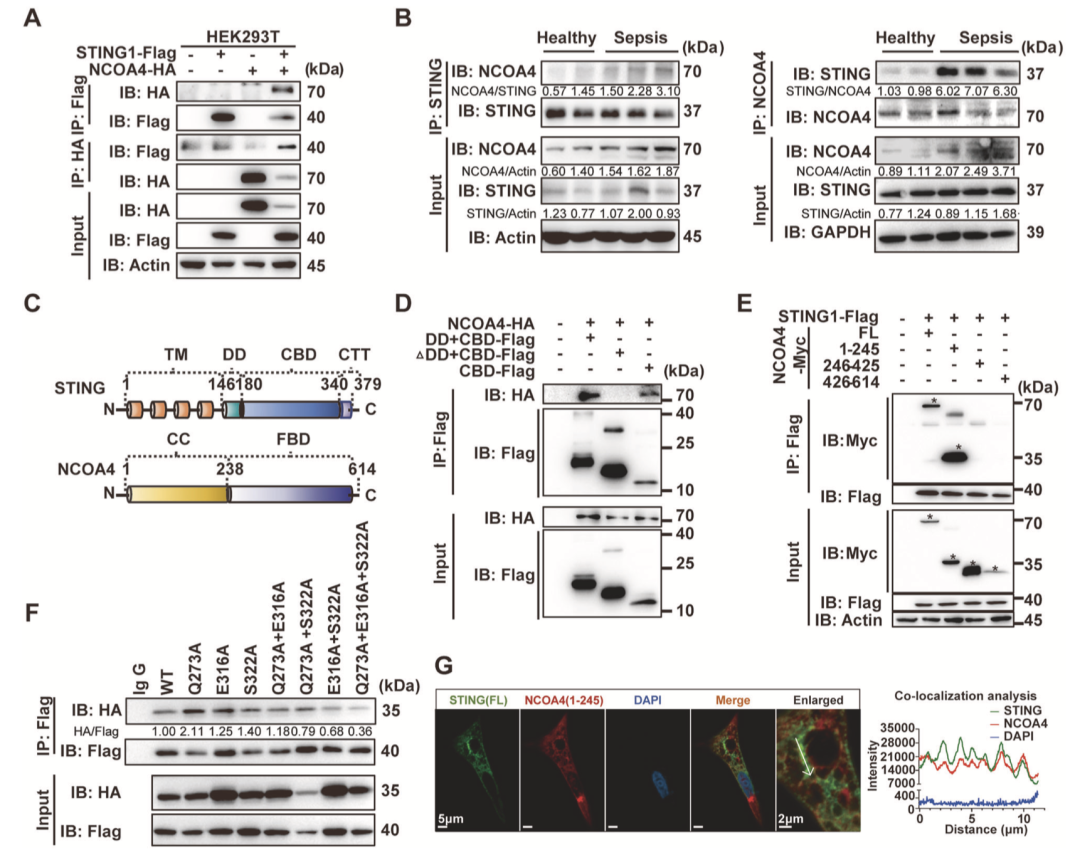 CDD丨STING 和 NCOA4 之间的相互作用通过调控巨噬细胞中的铁死亡和炎症反应加剧了脓毒症 - 知乎