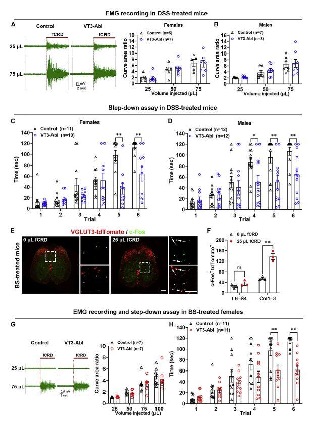 Neuron：马秋富团队报道选择性地传递情感性内脏疼痛的脊髓通路 - 知乎