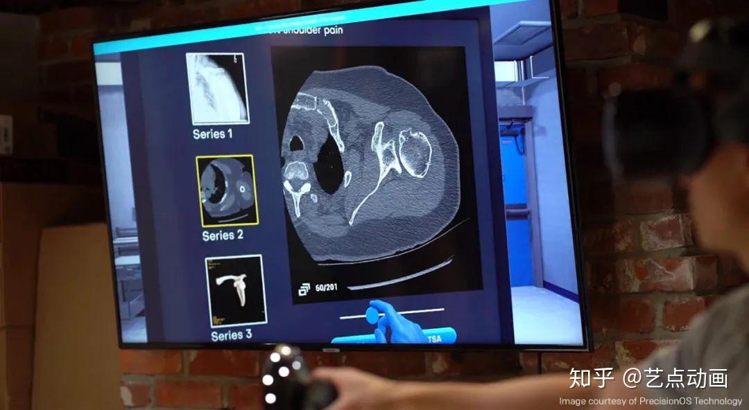 艺点动画 | 转载分享 | VR医学模拟使外科医生的培训速度提升5倍 - 知乎