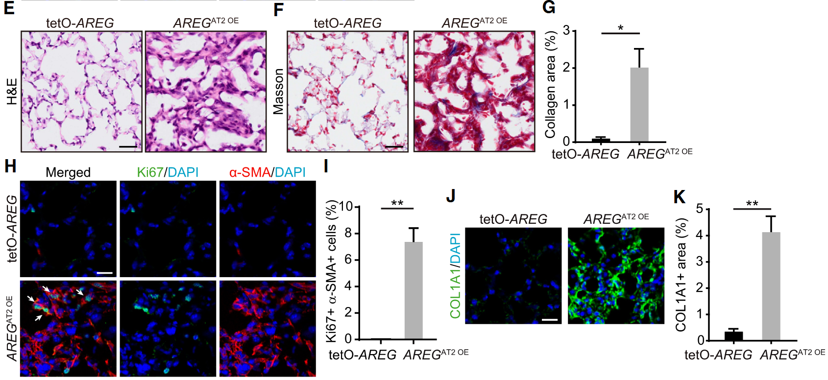 240919 文献精读Plus Cell Stem Cell AREG+肺纤维化 - 知乎
