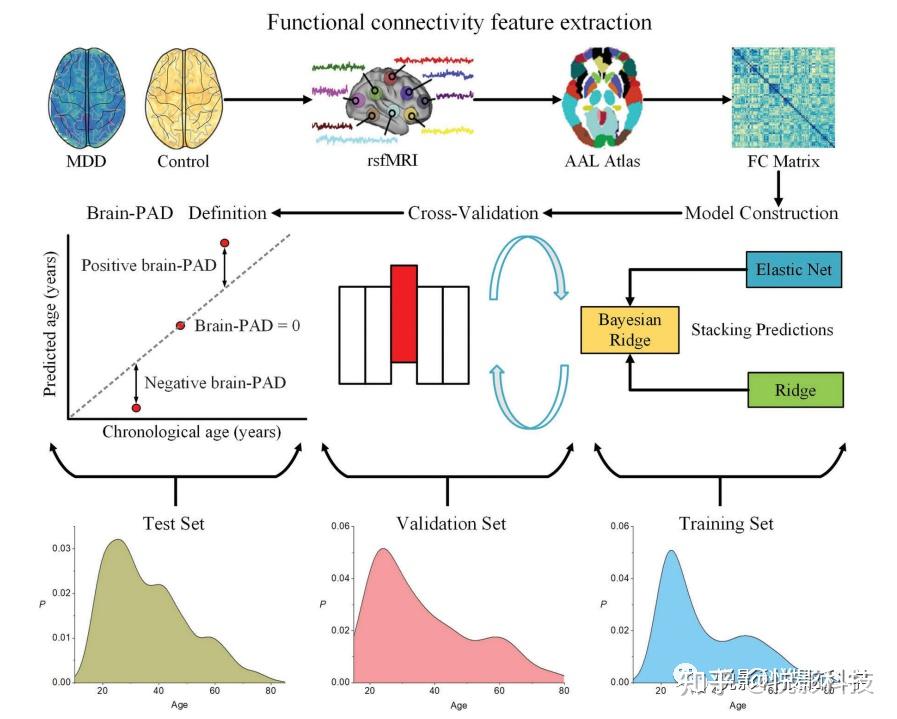 重度抑郁症患者的脑功能老化加速：来自中国大规模fMRI证据 - 知乎