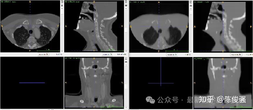 SynthRAD2025——用于放射治疗的计算机断层扫描生成挑战赛 - 知乎