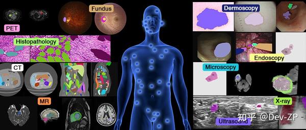 模型方法-为医学图像分割定制的高效模型SAM-Med2D - 知乎