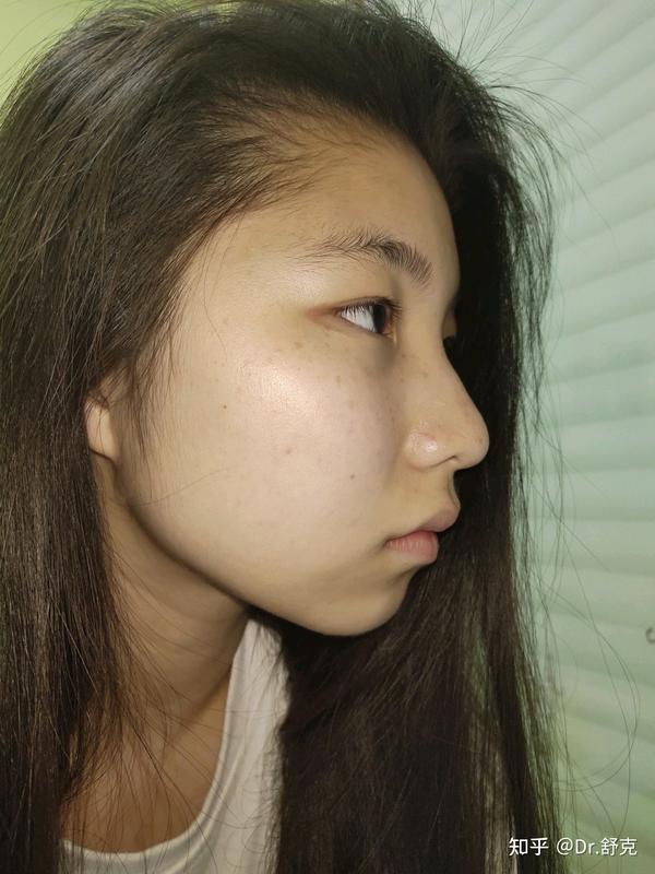 关于审美e线,你想知道的都在这里 知乎