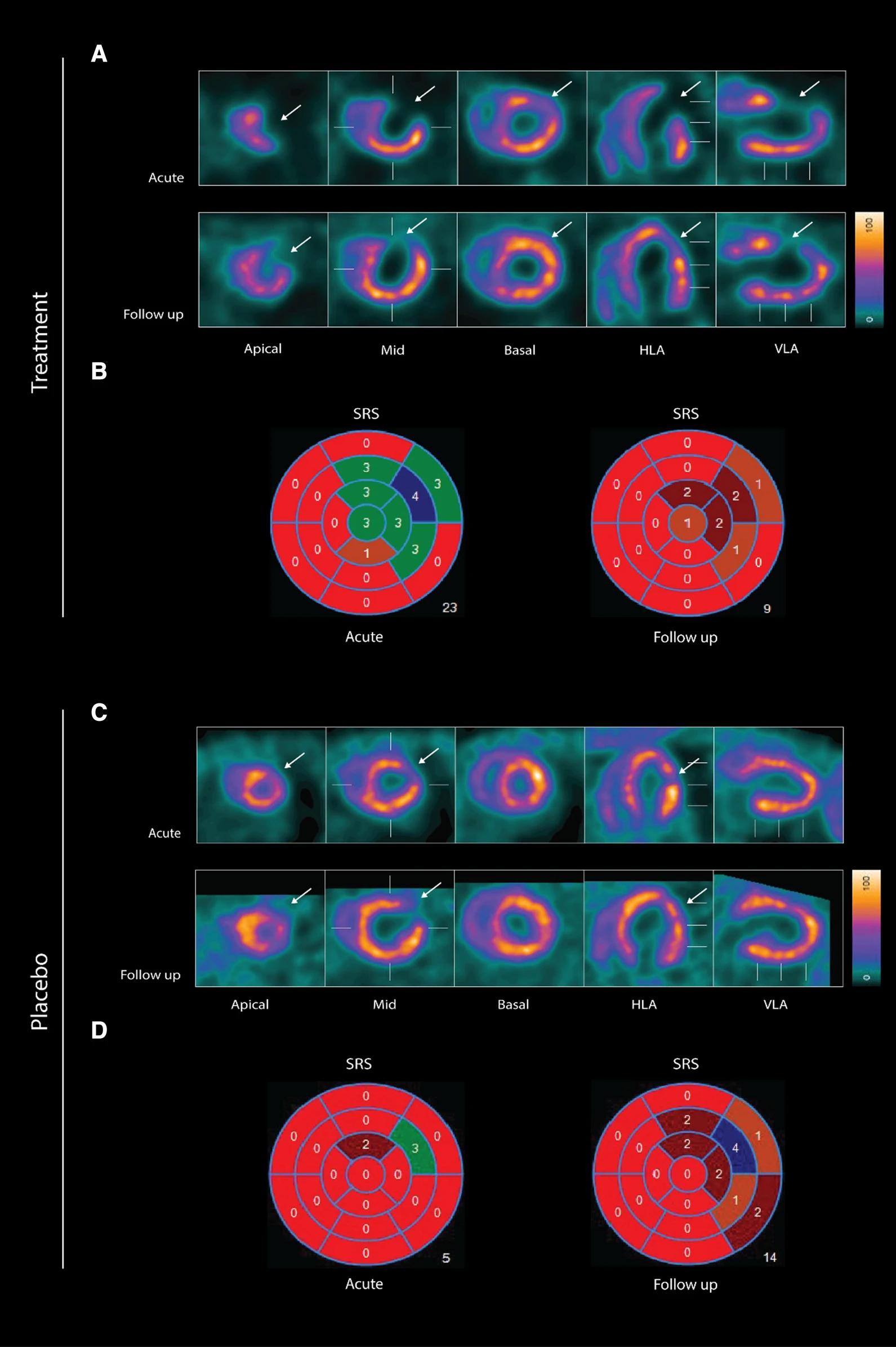 使用nanoScan SPECT/CT检测新的心脏保护剂SAX - 知乎