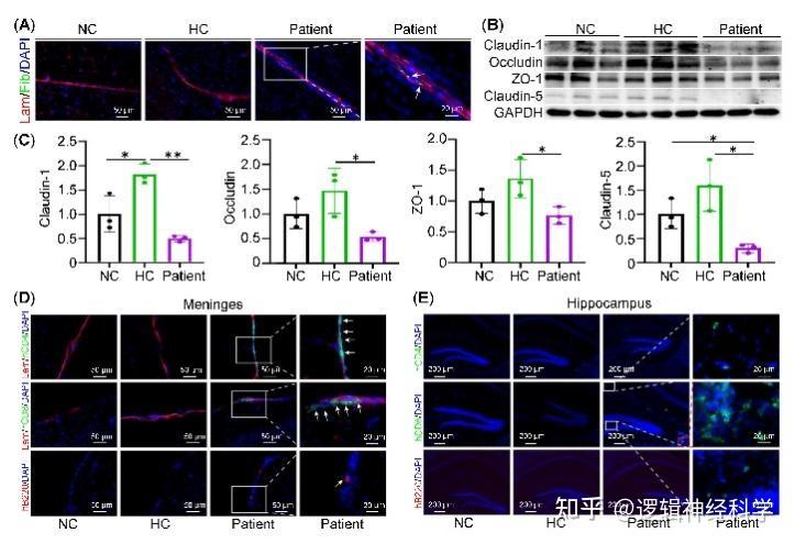 JNI︱邱伟/王杰/刘晓东团队合作首次构建人源化抗NMDAR脑炎模型并揭示发病机制及治疗靶点 - 知乎