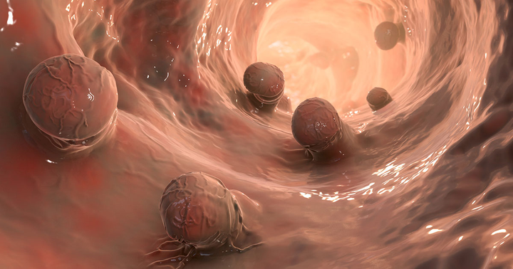 Cell Met | 微环境的氨可诱导结直肠癌的T细胞衰竭 - 知乎