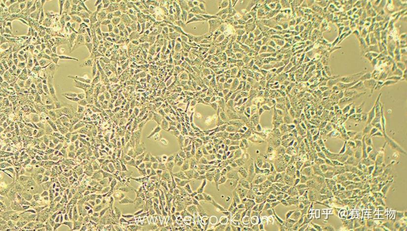 细胞学堂 |如何培养人正常支气管上皮细胞BEAS-2B - 知乎