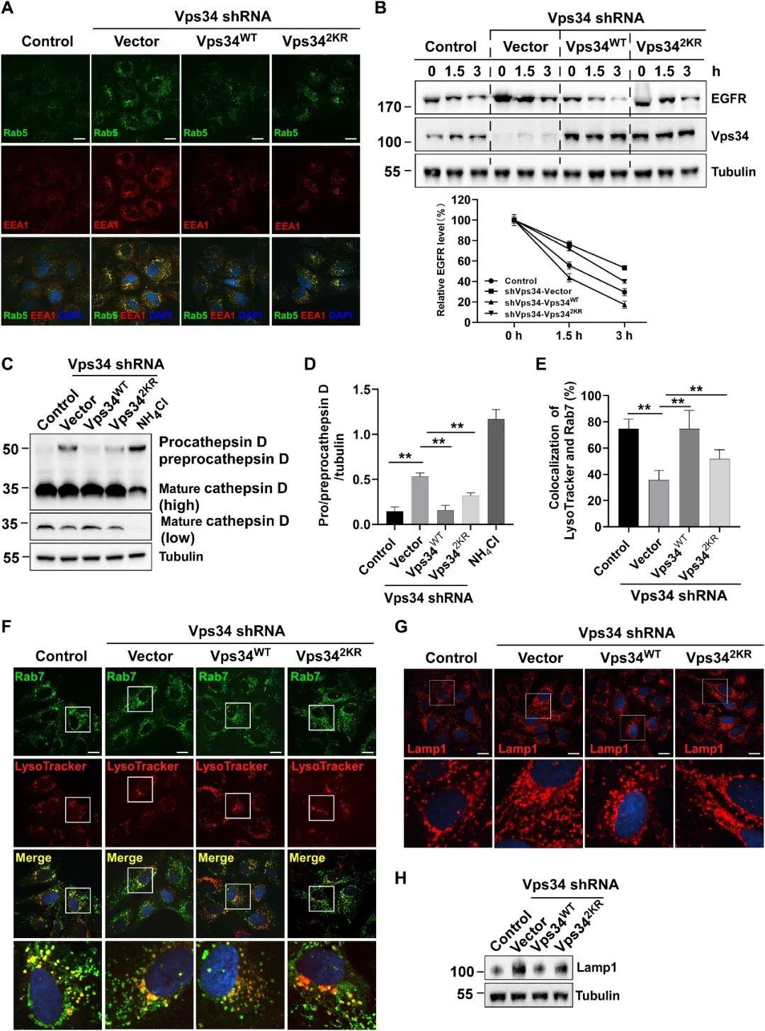 Sci Adv | 华东理工大学团队报道Vps34乳酸化修饰调控细胞自噬 - 知乎