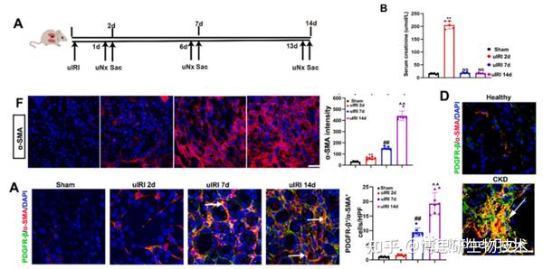 Metabolism: 肾纤维化的新治疗靶点—周细胞代谢重编程 - 知乎
