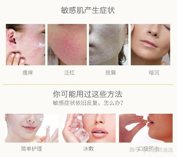 什么是敏感肌肤?如何判断? 知乎