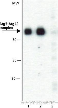 默克生命科学干货 | 抗-ATG5（C-末端） 兔抗 - 知乎