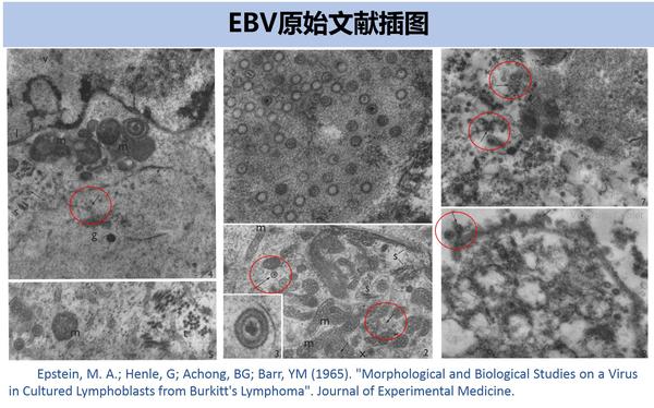 接吻病的元凶——EB病毒（上） - 知乎