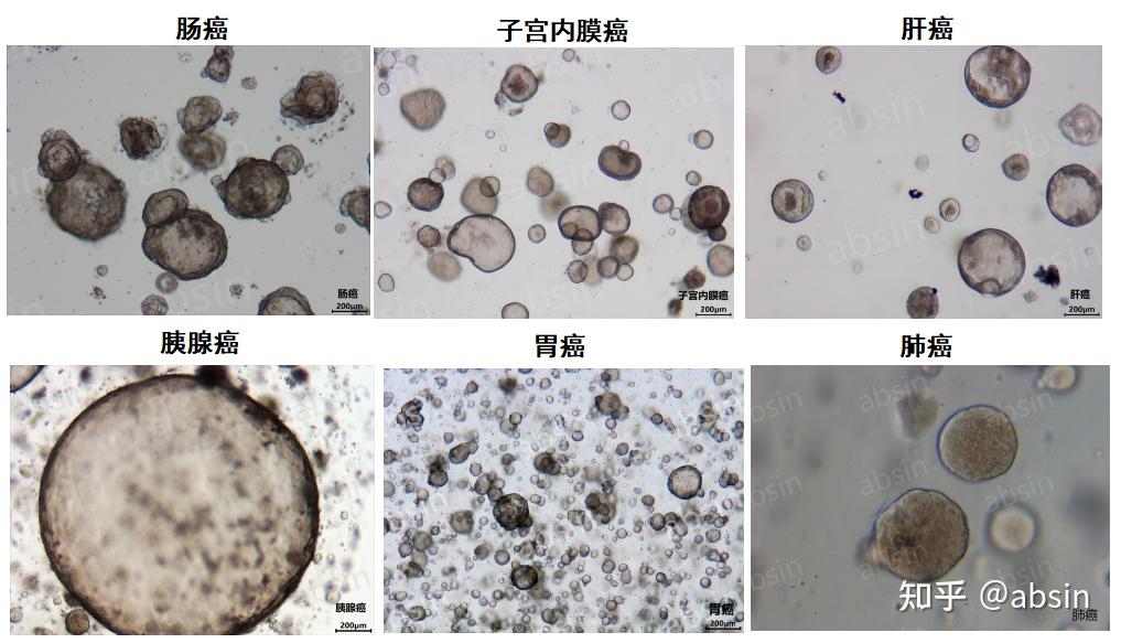 如何用类器官技术解决药物筛选问题？ - 知乎
