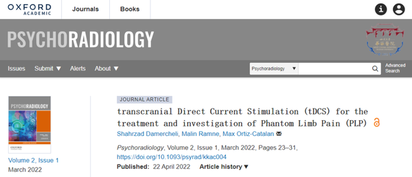 文献 | Psychoradiology：tDCS治疗幻肢痛时的潜在作用机理 - 知乎
