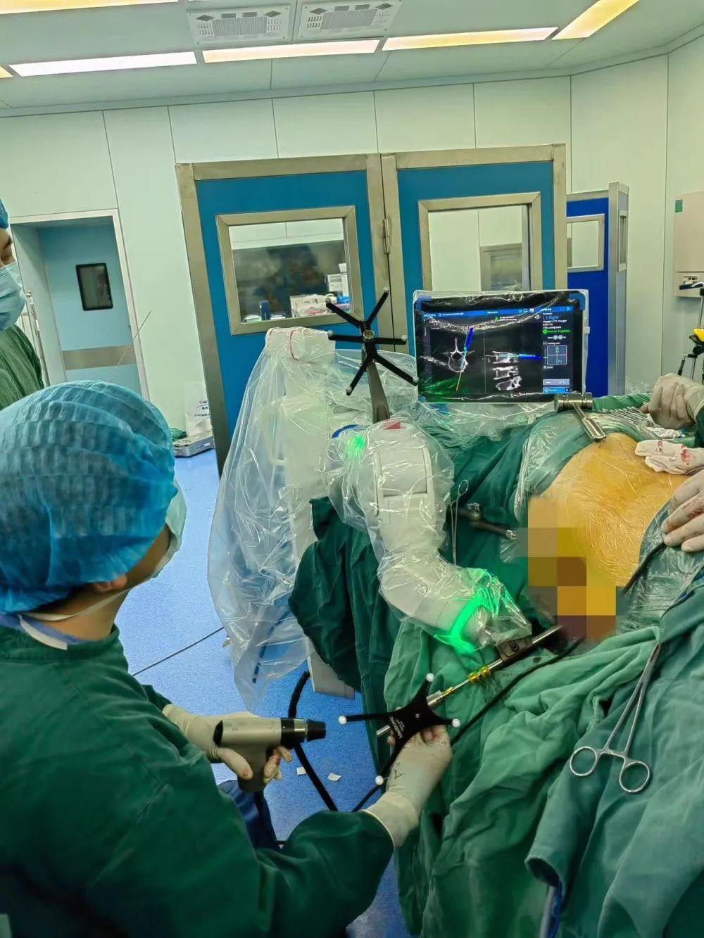 西南首例！脊柱手术机器人+OLIF“强强联合” - 知乎