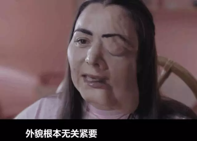 哪怕你的菊花长在嘴上,也能拥有爱! 知乎