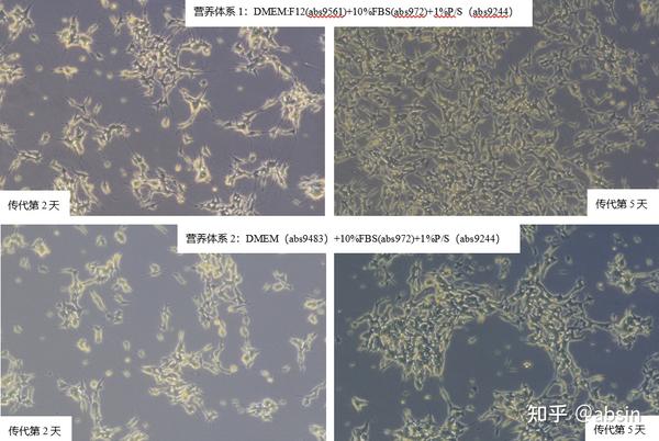 SH-SY5Y细胞培养攻略 - 知乎
